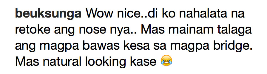 Erich Gonzales says she's not a retokada beauty | PEP.ph